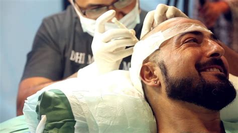 Hair Transplant Pricing What You Need To Know Before Booking Onedayhit