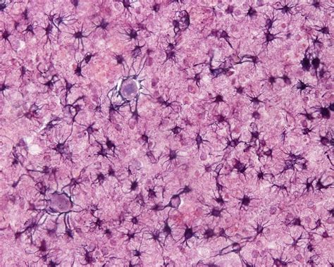 Astrocytes Light Micrograph Stock Image C051 7240 Science Photo Library