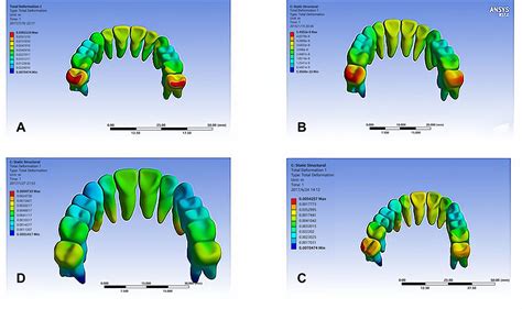 A 3 Dimensional Finite Element Analysis Ijgm