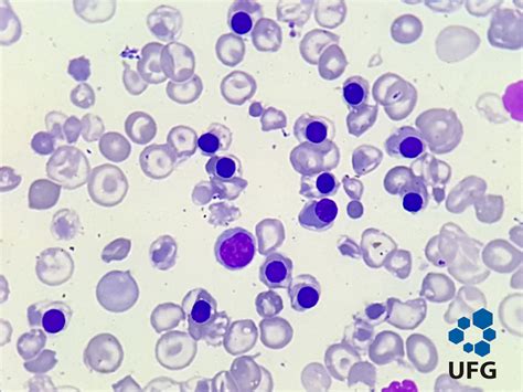 O Que é Eritroblastos Retoedu