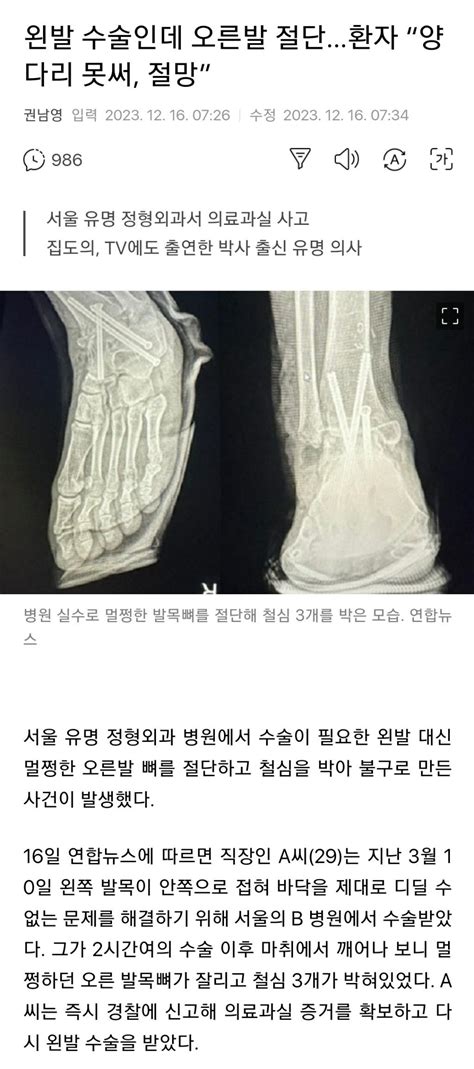 더쿠 왼발 수술인데 오른발 절단환자 “양다리 못써 절망”