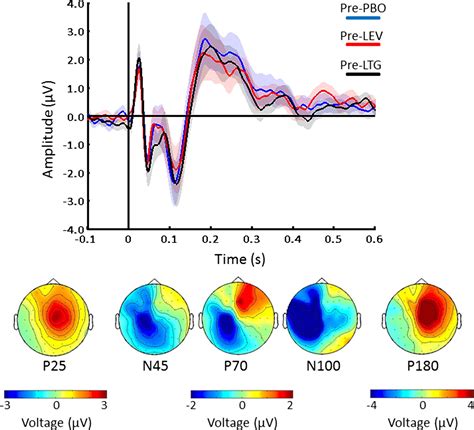 Tms Eeg — Csi Lab