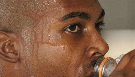 Diaphoresis Causes Treatment And Prevention