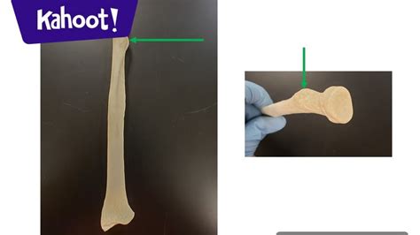 Radius Ulna Kahoot Quiz