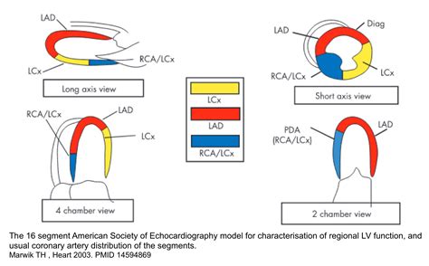 Acute Myocardial Infarction A Shifting Paradigm Recapem