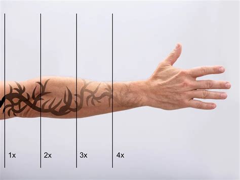 How Many Sessions To Remove A Tattoo Everything Explained My