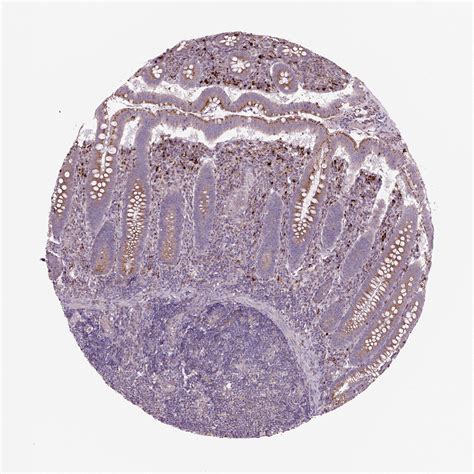 Tissue Expression Of Glb1 Staining In Appendix The Human Protein Atlas