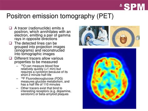 PPT Statistical Parametric Mapping For FMRI PET And VBM PowerPoint Presentation ID