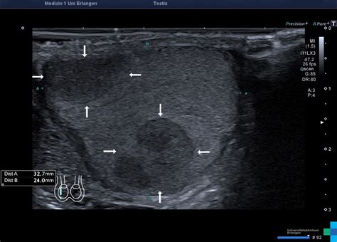 Hoden Sonographieatlas Erlangen