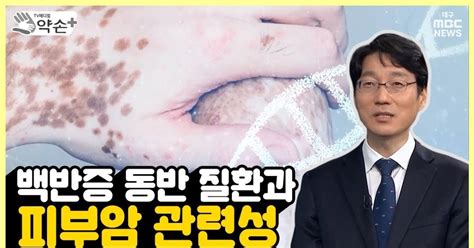 약손 피부의 흰색 반점 백반증 제대로 알기 ⑧동반 질환과 피부암 관련성