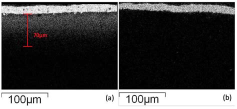 X Ray Mapping Of Scanning Electron Microscopy Sem Energy Dispersive