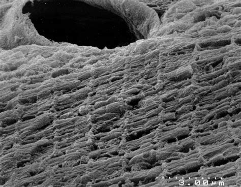 Scanning Electron Microscopy Images Central Microscopy Research Facility