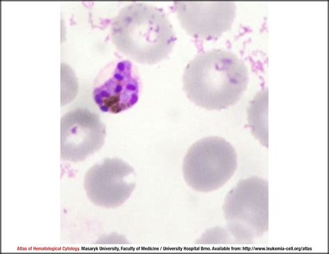 Plasmodium Malariae Cell Atlas Of Haematological Cytology