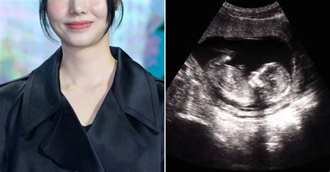 Top Actress Makes Stunning Pregnancy Announcement Koreaboo