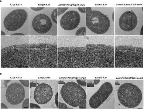 Morphology Of The Cell Wall Of Acinetobacter Baumannii Strains By Tem Download Scientific
