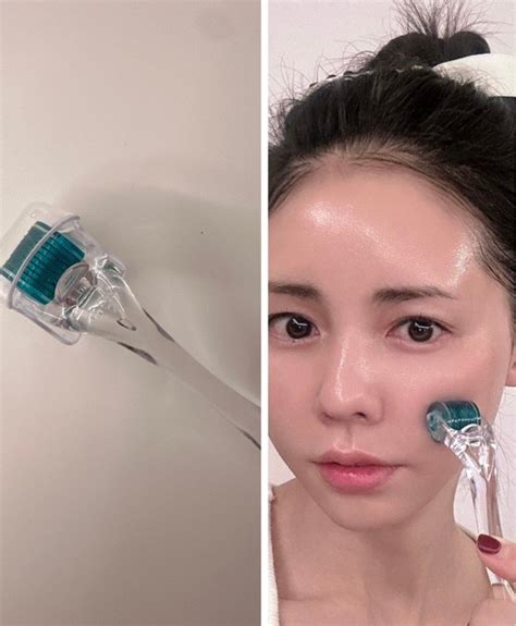 Mts롤러 홈케어 3개월 솔직후기 주기사용법부작용사후관리추천 네이버 블로그