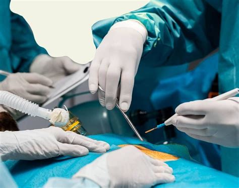 Plastibell Circumcision In Surat Elegance Clinic