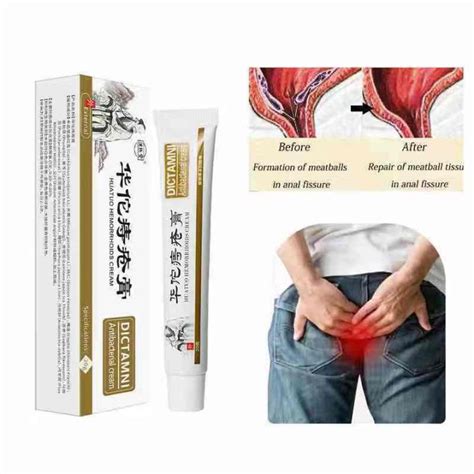 Antibacterial Hemorrhoids Almuranas Almoranas Chinese Herbal Cream