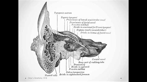 Mastoiditis Usmle Step 2 Review Youtube