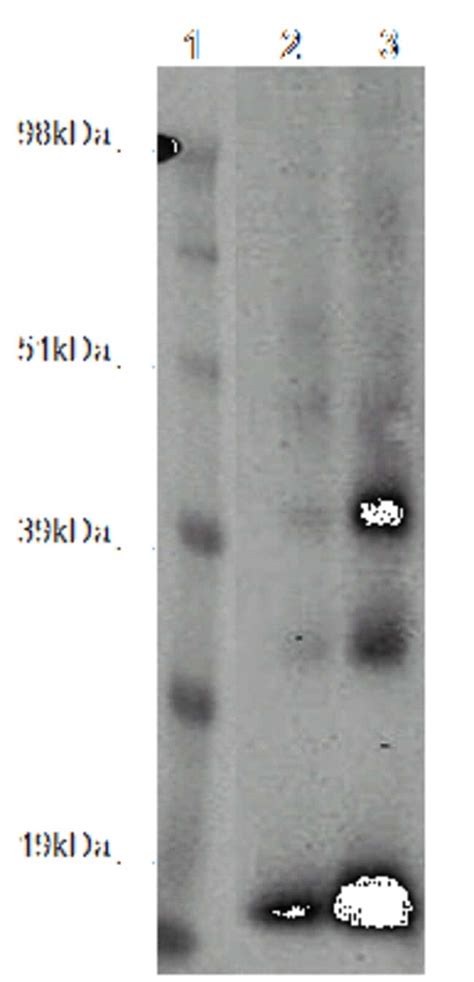 Discoverx Pathhunter Express Gpr6 Cho K1 Arrestin Orphan Gpcr Assay 1