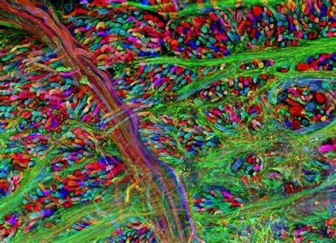 Image Of A Brain Stem From A Brainbow Transgenic Mouse Pics