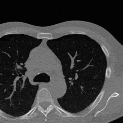 Dicom To Weird Animated  Via Python Machina Speculatrix