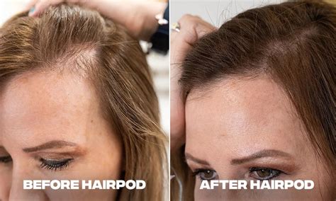 Hairpod™ Red Light Therapy And Microcurrent Scalp And Hair Care Device