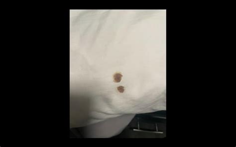 Are These Bed Bug Stains Rbedbugs