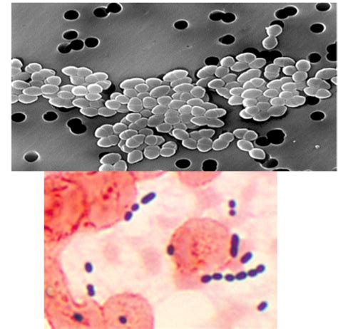 4 3 Bile Esculin Test Flashcards Quizlet