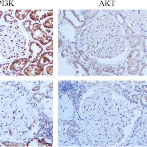 The Relative Expression Of Vegfa Pi3k And Akt A Download