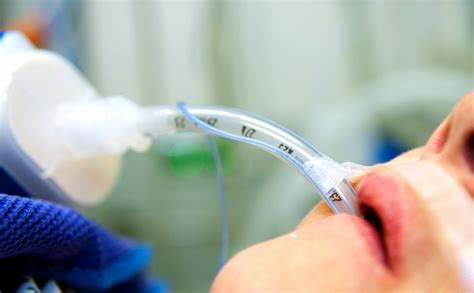 Para qué se realiza un coma inducido Bekia Salud