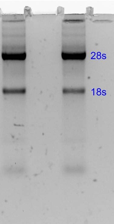 Can There Be Genomic Dna Contamination In An Rna Sample