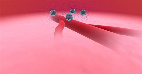 Premium Photo Anaphylaxis Histamine Release And Vascular Edema