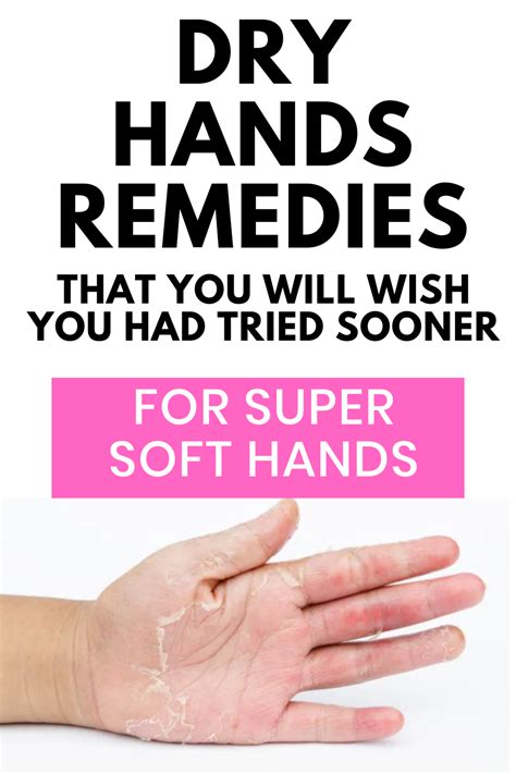 5 Diy Remedies For Dry Hands Say Goodbye To Cracked Skin Dry Hands