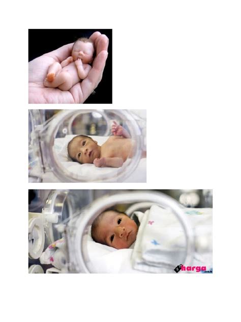 Gambar Bblr Pdf