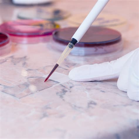 Anemia Profile Basic Motherwit Lab Jaipur