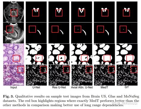 Transformer一脚踹进医学图像分割！看5篇miccai 2021有感 知乎
