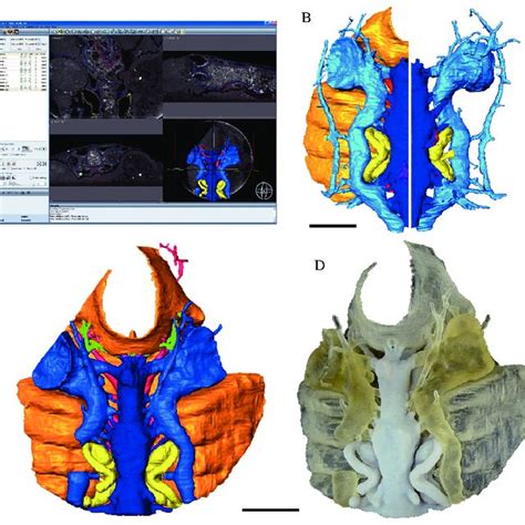 Synchrotron Radiation X Ray Tomographic Microscopy A SRXTM Device Of