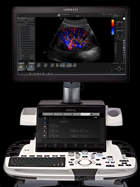 6tc Rs Standard Ultrasound