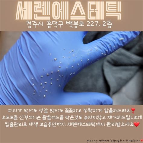 청주피부샵 피지제거잘하는 세렌에스테틱 네이버 블로그