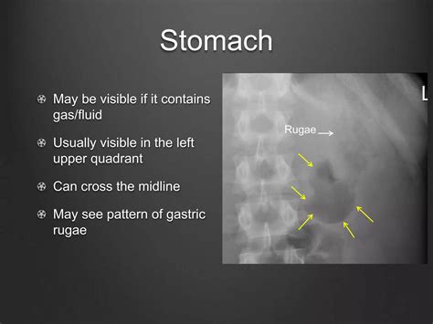 Approach To PFA Interpretation PPTX