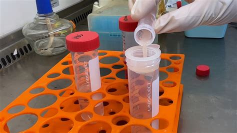 Isolation Of Stromal Vascular Fraction Svf From Perivascular Adipose