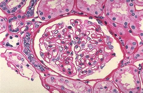 Glomerular Basement Membrane Histology