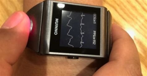 휴이노 심전도 웨어러블시계 국내 첫 의료기기 승인