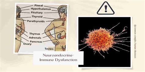 Neuroendocrine Immune Dysfunction Common Human Diseases