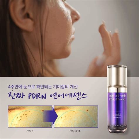 브라이트 공식계정 Smetic Official • Instagram Photos And Videos