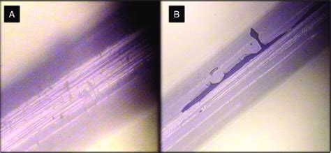 Polydioxanone PDO Thread After 24 H Of Immersion In HA A Reflected Download Scientific