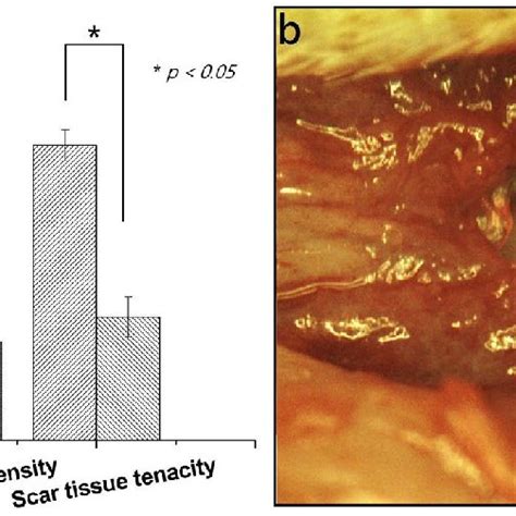 A Epidural Fibrosis Dura Adhesion Fibroblast Cell Density And Download Scientific Diagram