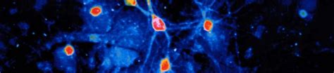 Fibronectin Human Fibronectin Hfn Coating Corning