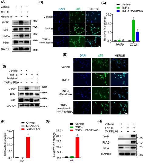 Melatonin Mediated Yap Upregulation Attenuates Tnf α Induced Nf κb